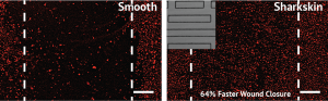 Sharkskin Wound Dressing - Sharklet Technologies, Inc.